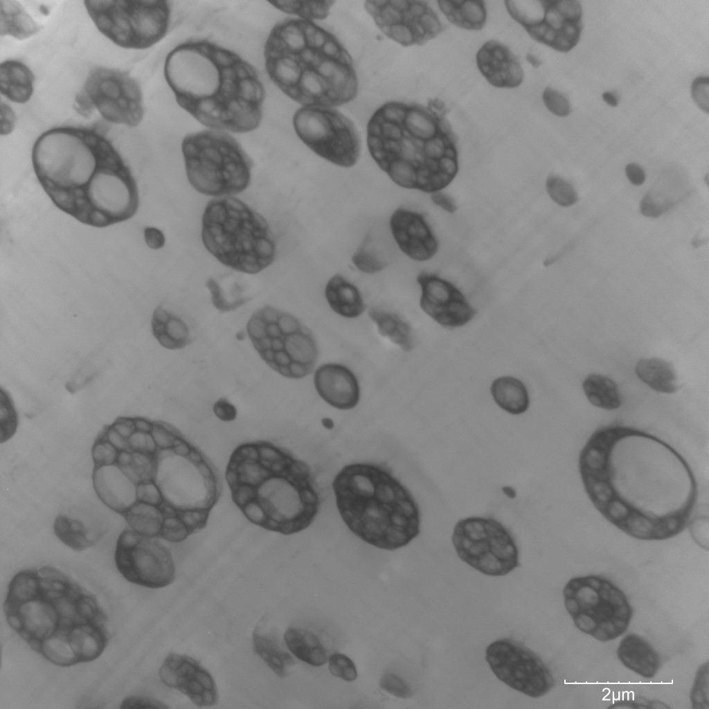 Case Study: TEM Analysis of Polymer Rubber Blend Using Cryo ...